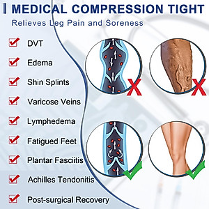 Medical Compression Pantyhose Women & Men,20-30mmHg Open Toe Thigh High Compression Tights Graduated Support (Beister)