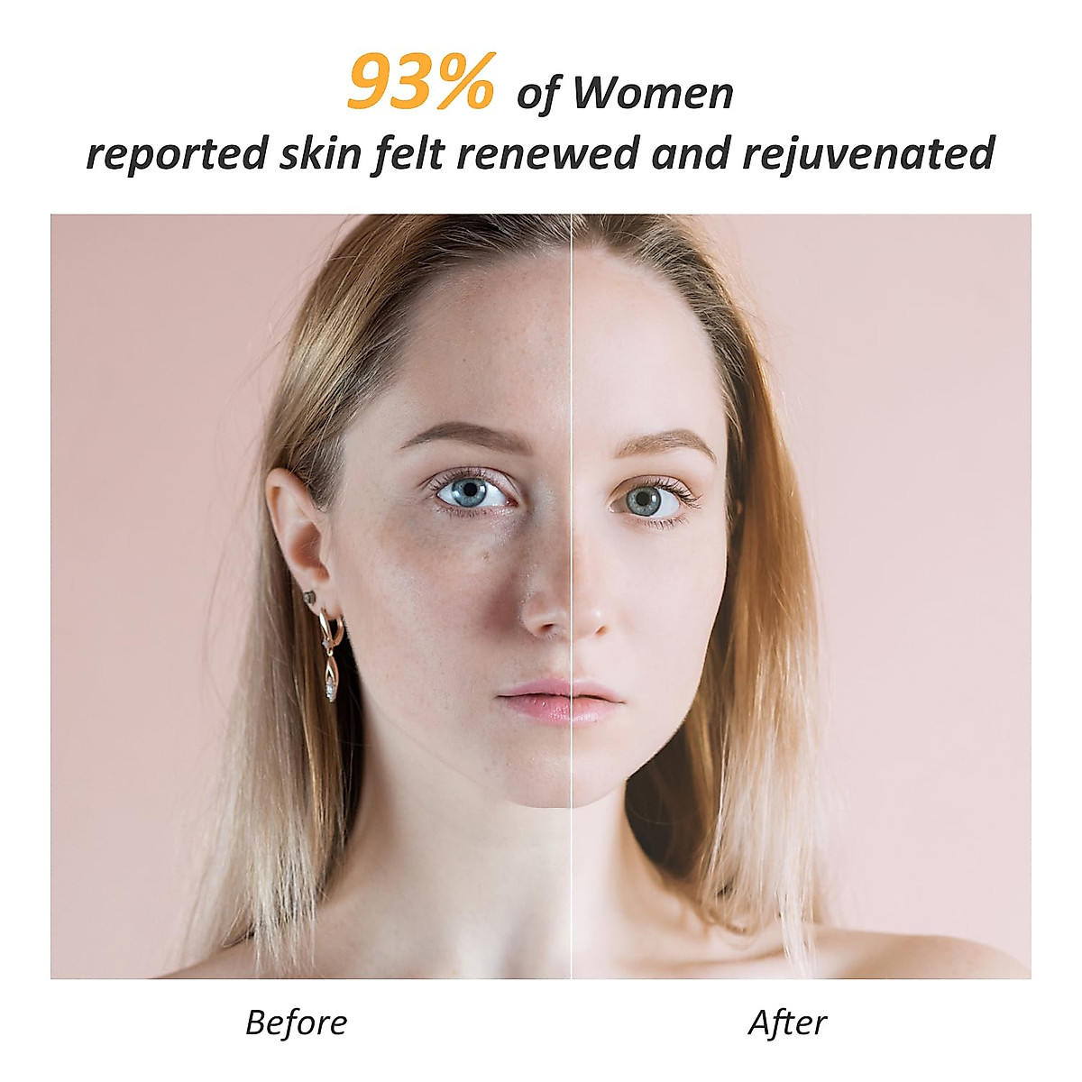 WarmDerm Skin Firming Facial Device, Professional Home Beauty Device for Face and Body, 3 Energy Levels - Salon Results