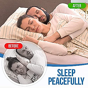 AVEELA Anti Snoring Chin Strap for CPAP Users | Large | Keep Mouth Closed While Sleeping | Adjustable Premium Snore Stopper Head Strap for Men and Women | Itch-Free Material for Uninterrupted Sleep