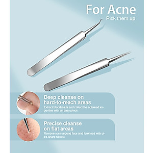 Pimple Popper Tool Kit, Upmore 6PCS Blackhead Remover Professional Stainless Acne Blemish Comedone Extractor Removal Tools with Metal Case and Tweezers for Whitehead Acne on Nose Face