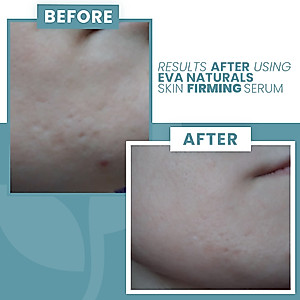 Eva Naturals Skin Firming Serum with Niacinamide and Hyaluronic Acid, 1 oz