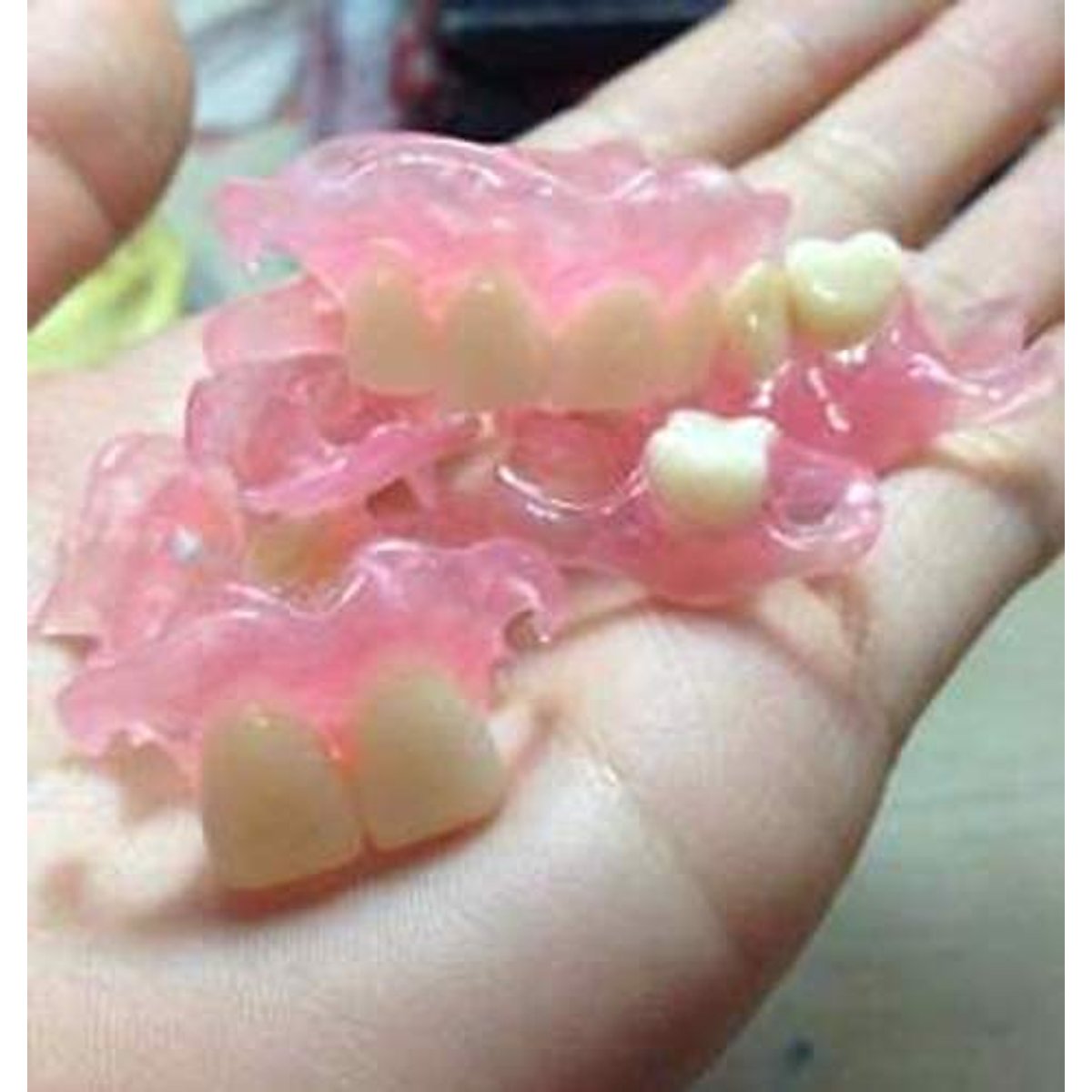 "Nesbit bridge" , Flipper Uppler and Lower Set of Affordability Flexible Valplast Customized Partial Denture (Pink, Valplast)