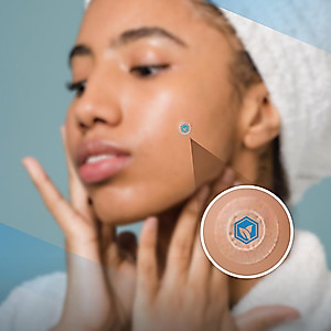 Hydrocolloid Acne Patches for Pimples, Zits and Blemishes - Absorbing Zit Patches for Face - Acne dots for Sensitive Skin - Fast Drying Acne Stickers and Zit Stickers for Face