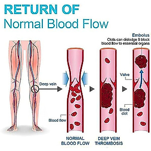 VIPUDA Pearl Moon Ionic Correction Lymphatic Detoxification Long Tube Silk Stockings (Skin*2)