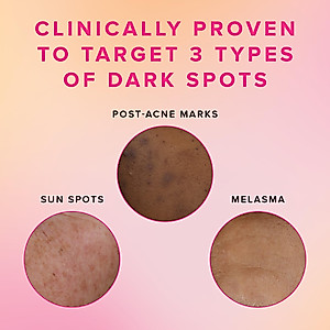 Farmacy 3% TXA Toner for Face - Brightening Face Toner for Oily Skin - Liquid Exfoliant with Azelaic Acid + 5% PHA to Target Visible Dullness + Help Reduce Uneven Skin Tone (120ml)