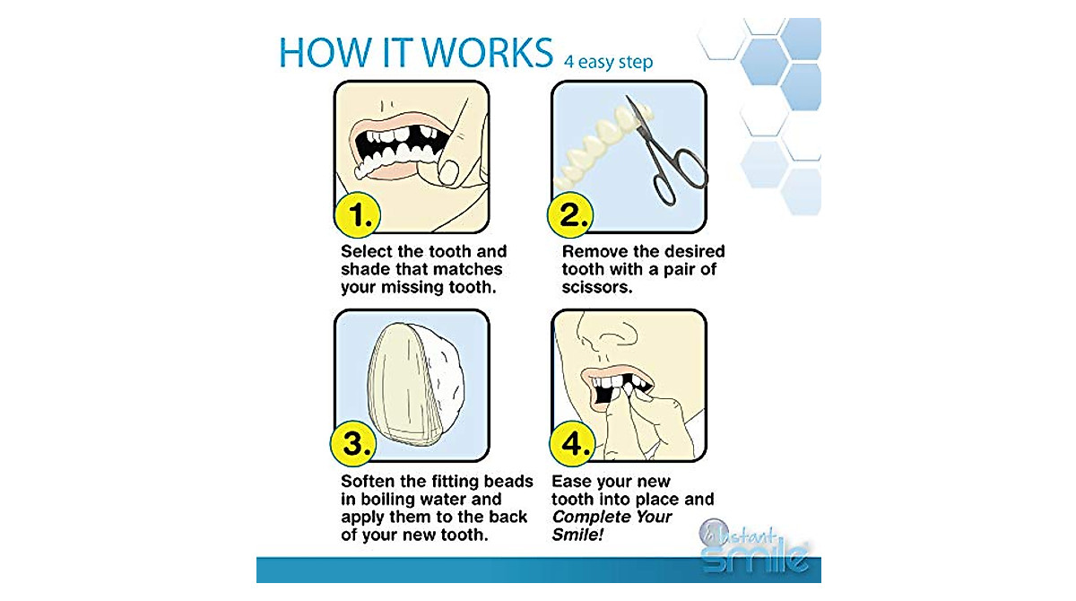 Instant Smile Complete Tooth Replacement Kit | Fast & Natural Look