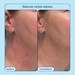 Skinfix Barrier+ Triple Lipid-Peptide Cream: Enriched with Lipids, Peptides, Hyaluronic Acid, and Shea Butter for Brightening, Firming, and Plumping, 1.7 oz