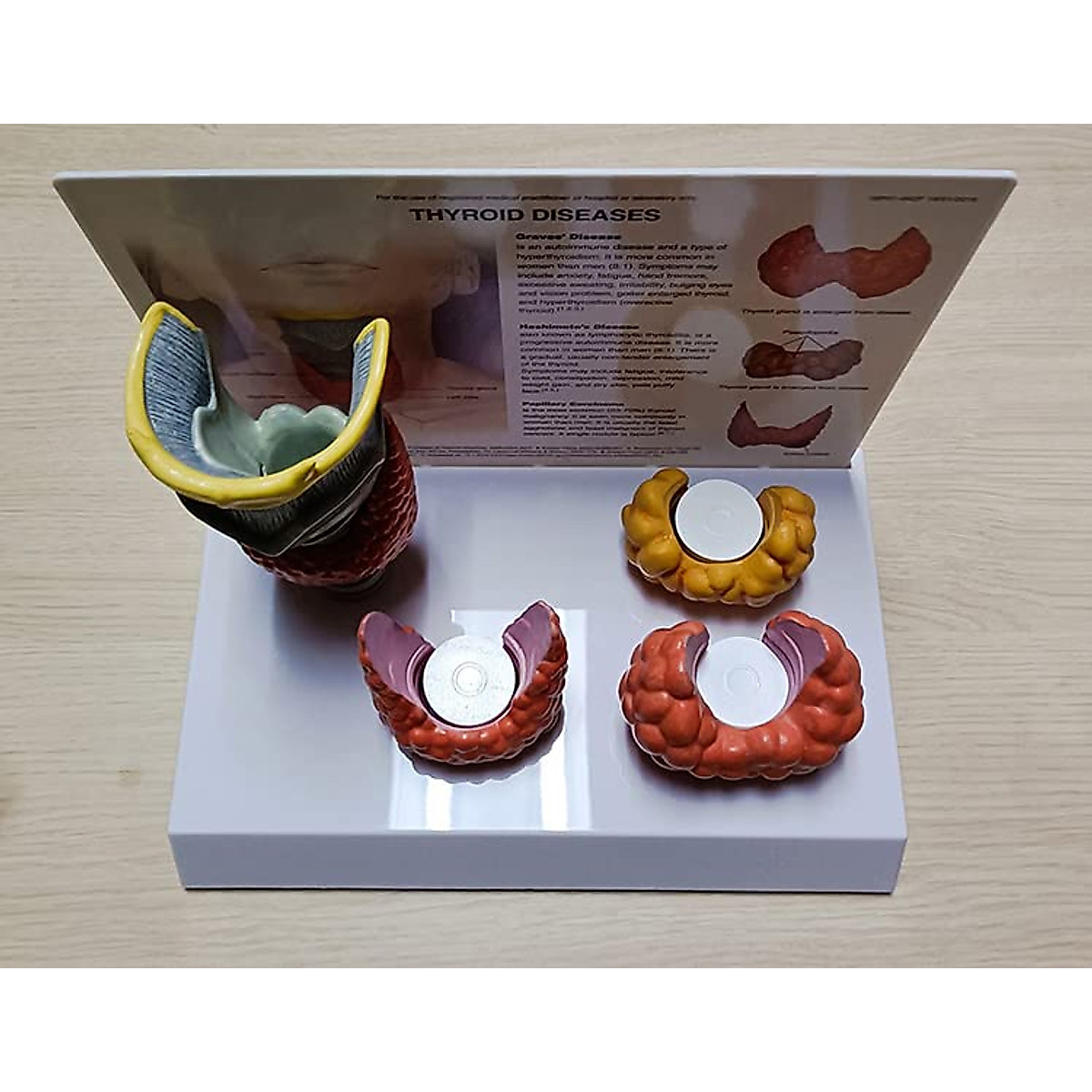KH66ZKY Thyroid Anatomy Model - Thyroid Nodule Model - for Science Classroom Study Display Thyroiditis Mastoid Cancer Teaching Medical Model