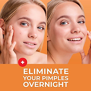 PatchRx Acne Patches (120 Count) with Hydrocolloid Only, Hydrocolloid Pimple Patches for Face - Zit Patch Acne Dots - Acne Patches - Pimple Patch with 3 Size Acne Stickers