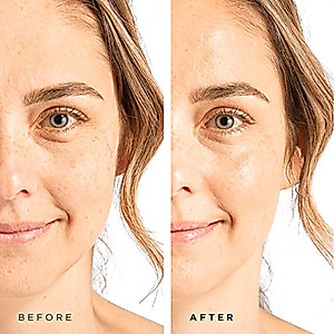 Tree of Life Hyaluronic Acid Hydrating Facial Serum with Brightening Vitamin C, Smoothing & Tightening for Face, Clean Dermatologist-Tested Skin care, Bonus Size 2 Fl Oz