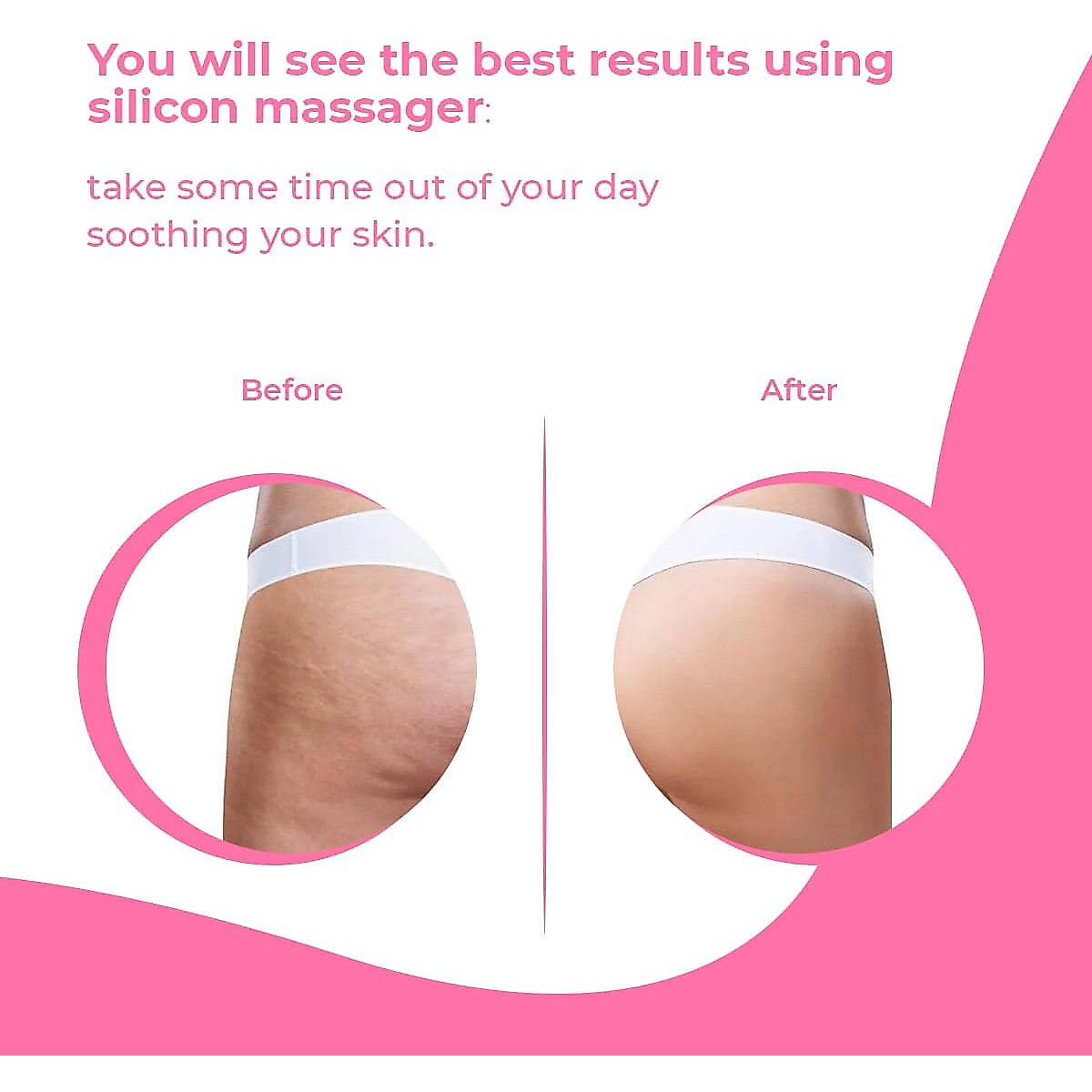 Cellulite Remover Anti Cellulite Massager Roller - Anticellulite Fascia Blaster for Cellulite Treatment - Improves Fat Deposits Use Cellulite Brush & Cellulite Roller with Cream or Oil