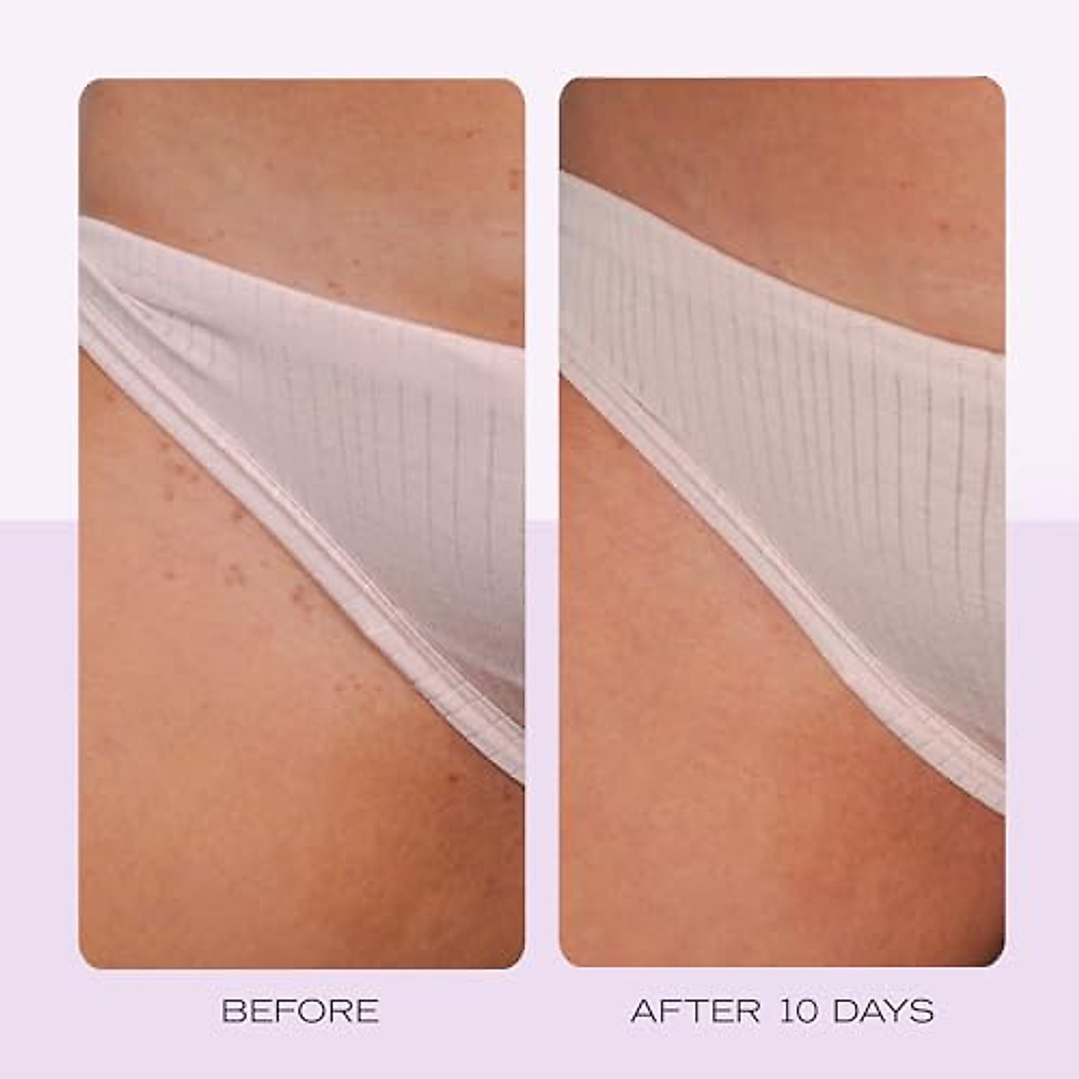 First Aid Beauty Ingrown Hair Pads with BHA + AHA – Ingrown Treatment Pads Exfoliate to Help Prevent Razor Bumps – For Underarm + Bikini Area – Compostable for Daily Use – 60 pads