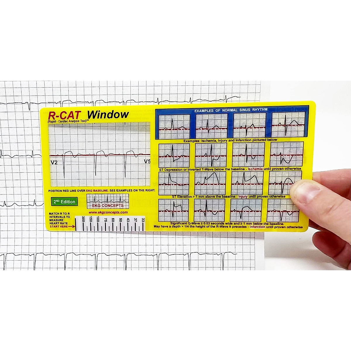 R-CAT EKG Window 2nd Edition