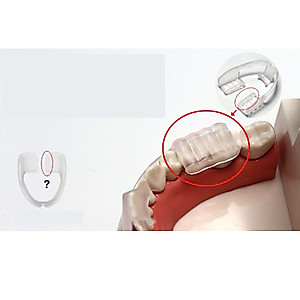 BESPORTBLE 3Pcs Dental Night Protector Dental No More Teeth Grinding Food Grade EVA Supplies for Kids (Transparent)