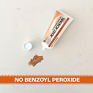 Adult Acnomel Acne Medication Cream, 1.3 Ounces