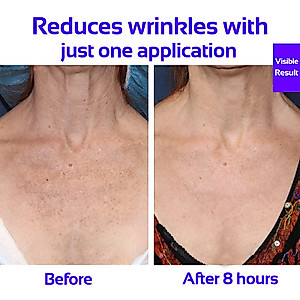 Skywee Professional Products Anti Wrinkle Chest Silicone Pad, Resuable and 100% Medical Grade Décolleté Anti Wrinkle Patches, Smooth Your Skin Set of 2