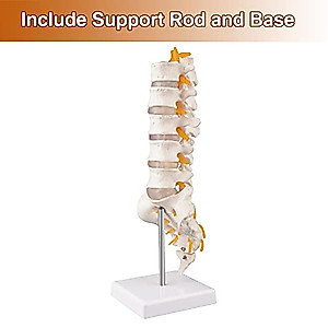 Ultrassist Human Spine Model with 5 Lumbar Vertebrae, Herniation Discs, Lumbar Nerves and Spinal Cord for Medical Teaching