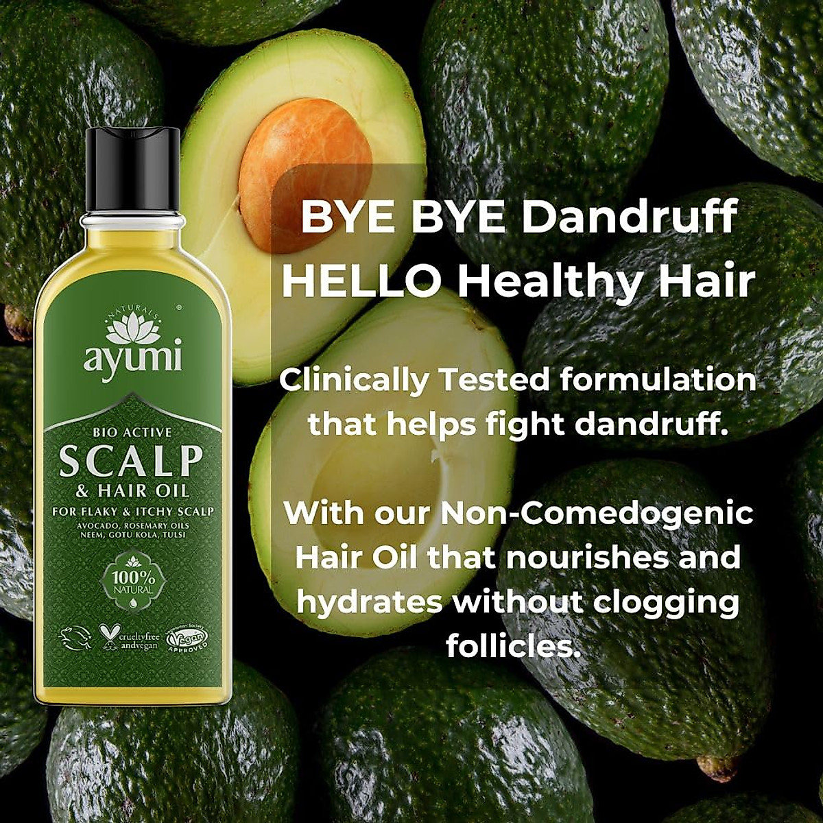 Ayumi Bio-Active Scalp & Hair Oil | Clinically Tested to Reduce Dandruff and Dry Flakes | Soothes Itchy Scalp | Pre Shampoo Treatment | Nourishes & Protects Hair Strands | 5.1 Fl Oz