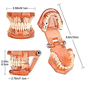 Maxmartt Teeth Model, Dental Demonstration Dental Implant Removable Study Model Teeth Teaching Model for Student Teacher, Orange