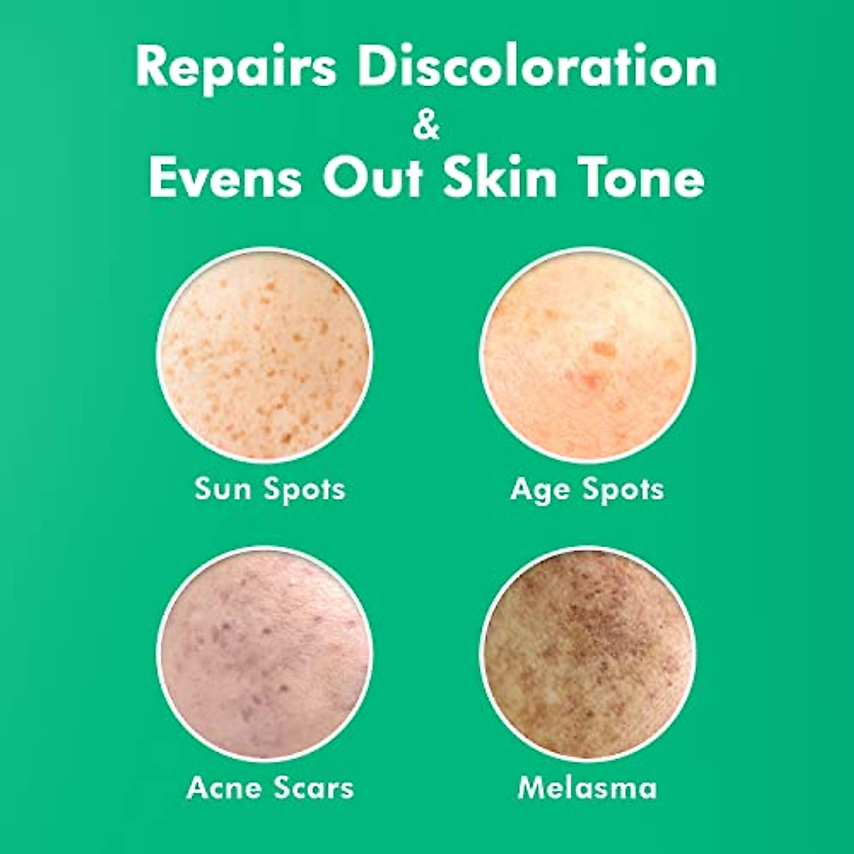 Ebanel Dark Spot Remover for Face Peel Skin Brightening Cream Melasma Hyperpigmentation Treatment Sun Spot Age Spot Freckle Remover Fade Cream, Synovea, 4-Butylresorcinol, Niacinamide, Glutathione
