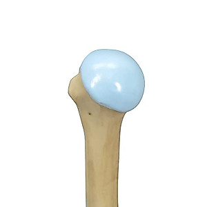 GPI Anatomicals Shoulder Joint Model Set | Human Body Anatomy Replica Set of 4-Stage Osteoarthritis Shoulder Joint for Doctors Office Educational Tool