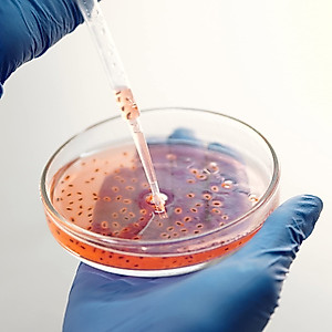 JOIKIT 80 Pack Sterile Plastic Petri Dishes, 90mm Dia × 15mm Deep Petri Dishes with Lids, Lab Petri Dishes with 200 Plastic Transfer Pipettes for Laboratory Studies, Scientific Research