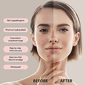 HARUTO Acne Pimple Patches XL (10 patches/1 pack) - Hydrocolloid Large acne Patches Spot Treatment, Tea tree spot patch, acne sticker for Body and Larger Breakouts,