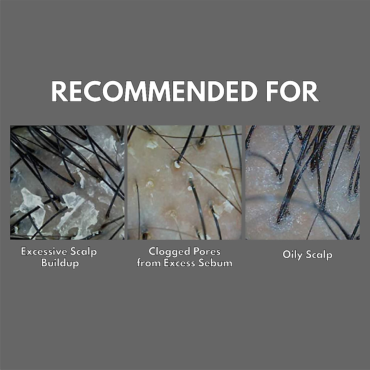 LA'DOR Anti-Dandruff Shampoo (16.9 fl.oz.) - For Oily Scalp with Dandruff, Gently Cleanses Away Dead Skin Cells, Alleviates Itching and Irritation LADOR