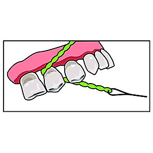 IDontix Brace X-Floss, Green