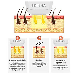 Skinna IPL Laser Hair Removal System | Laser Hair Remover, Permanent Hair Removal for Women & Men | Hair Laser Removal at Home for Face, Arms, Legs, Body, Bikini Line | Painless Hair Removal Laser