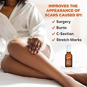 Palmer's Cocoa Butter Formula Scar Serum, Skin Brightening Oil for Face & Body, Concentrated Serum with Vitamin E, Fragrance Free, 1 Fl Oz