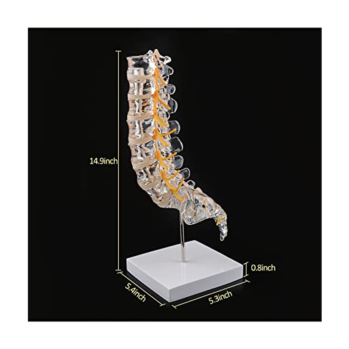 Ultrassist Human Lumbar Spine Model with Sacrum, Spinal Nerves and Herniation Disc, Includes Base for Display, Life Size Spine Model for Medical Education