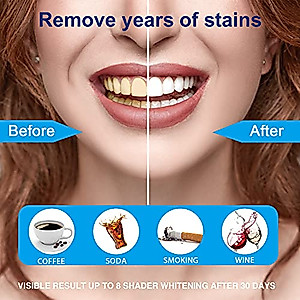 EZGO Teeth Whitening Strips, 28 Non-Sensitive White Strips Teeth Whitening Kit, 14 Sets Fast-Result Teeth Whitener for Tooth Whitening, Helps to Remove Smoking, Coffee, Wine Stains, Gentle and Safe