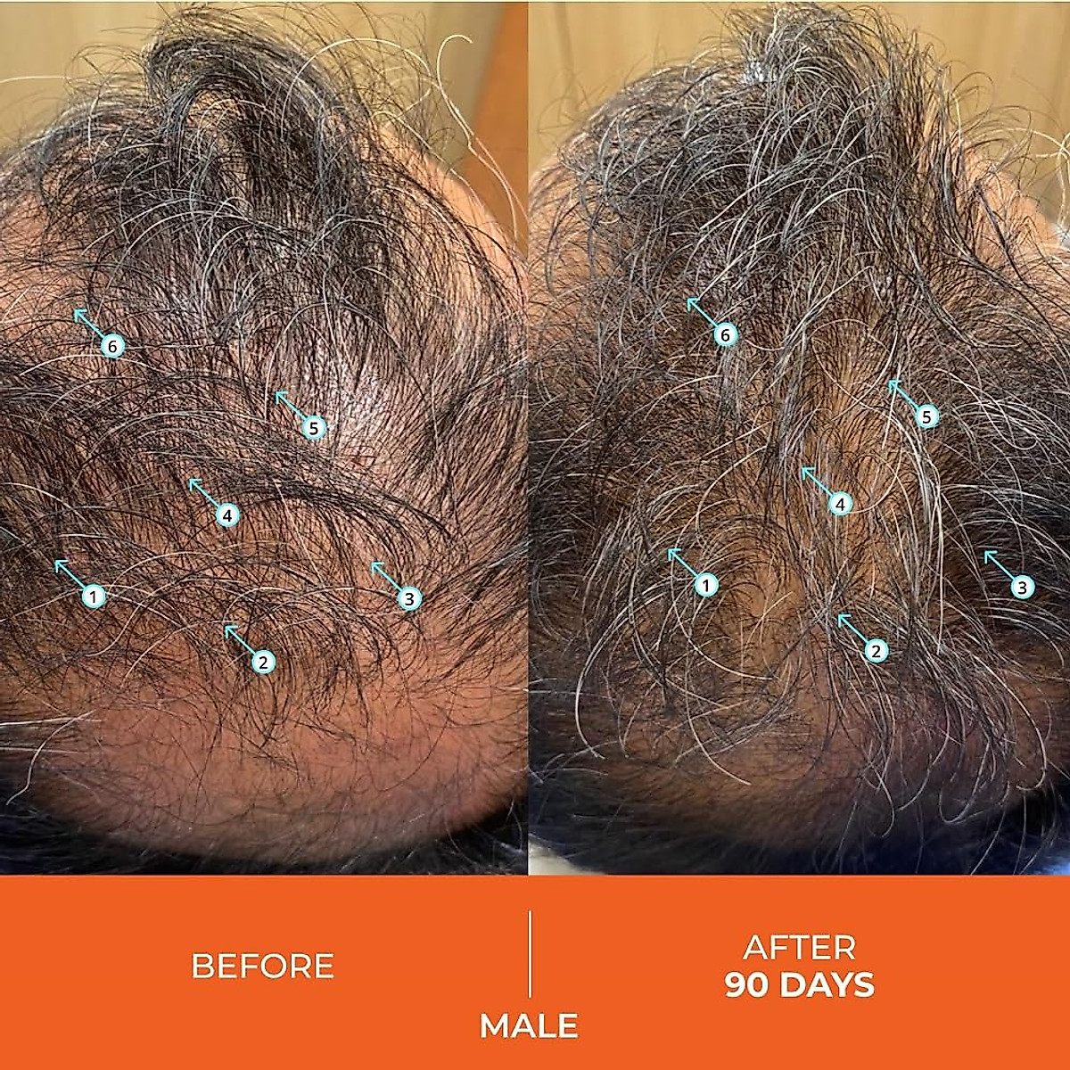 DS Laboratories Revita Hair Growth Conditioner for Fine & Thinning Hair, Biotin Treatment for Hair Regrowth, Thickening & Loss Prevention