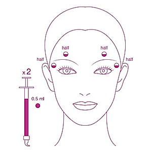 Fillerina Labo Eyelid Lifting Treatment Grade 1, Gel and Cream for firming the forehead and eyelids.