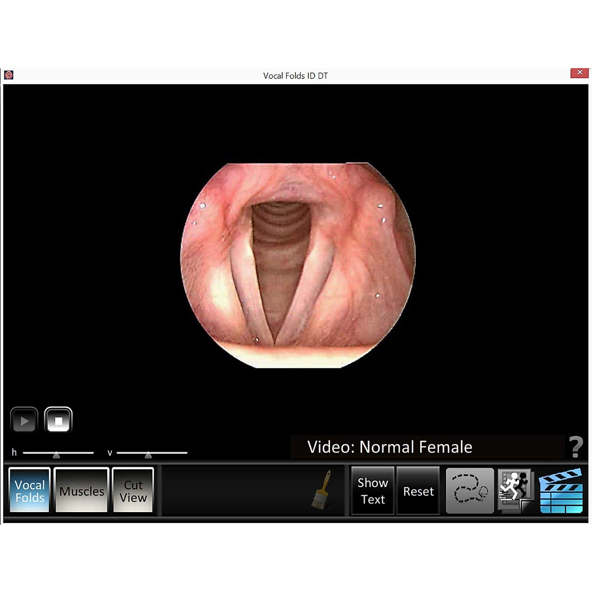 Vocal Parts, Pharynx & Larynx Anatomical Chart with Software Larynx and Vocal Fold ID Speech Language Pathology, SLP, Singing