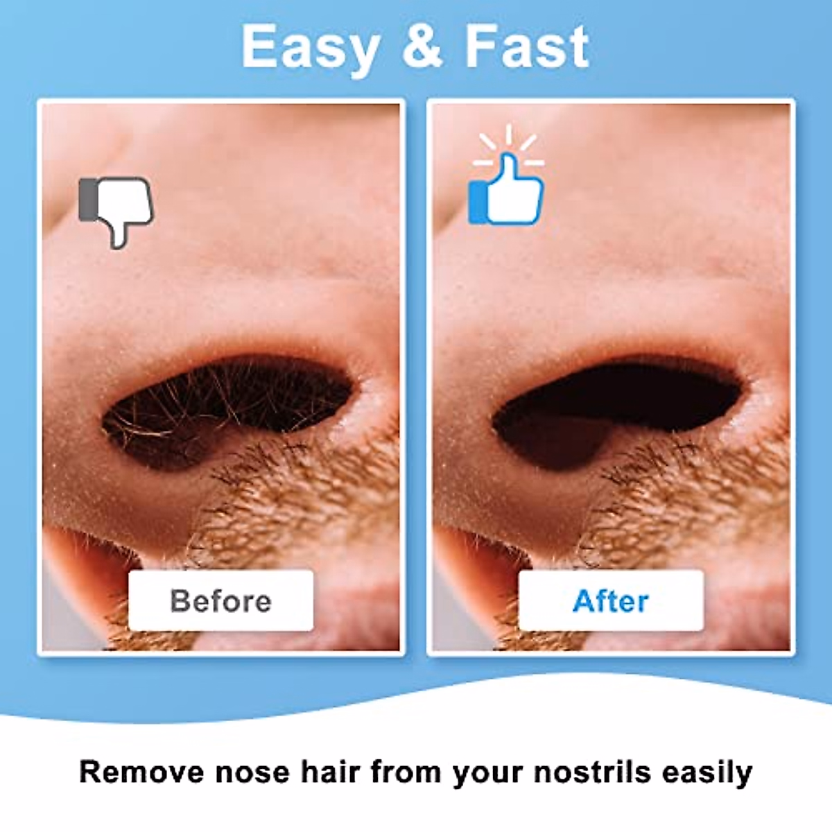 Keethem Nose Wax Kit for Men and Women - Instant Hair Removal, 100g Hard Wax, 20 Applicators, 10 Mustache Guards, and 10 Paper Cups - Painless, Safe, and Long-Lasting Results with 20x Usage - Black Applicators