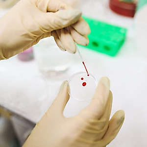 Bekith Petri Dishes with Lids, 50 Pack 90mm Dia x 15mm Deep Plastic Sterile Container, 50 Pack Plastic Transfer Pipettes(3ml)