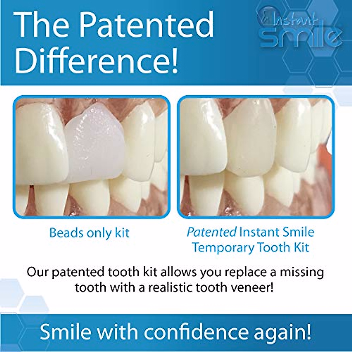 Instant Smile Complete Your Smile Temporary Tooth Replacement Kit ...