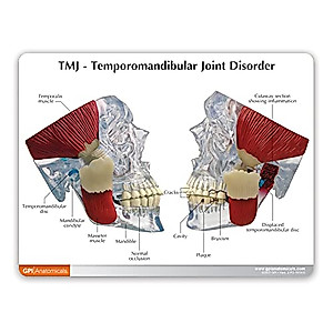 GPI Anatomicals - Temporomandibular Joint (TMJ) Model, Replica with Pathologies for Human Anatomy and Physiology Education, Anatomy Model for Doctor's Offices and Classrooms, Medical Study Supplies