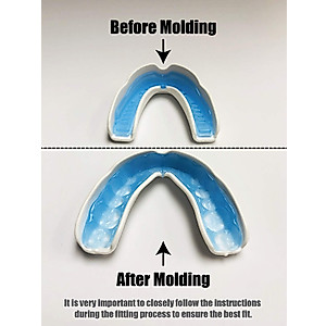 COOLLO SPORTS Boil and Bite Mouth Guard DC Custom Fit Sport Mouthpiece for karate, martial arts, wrestling, Boxing, MMA (Free Case Included!) -Adult size (Adult -Ages 11 & above, Trans. & White)