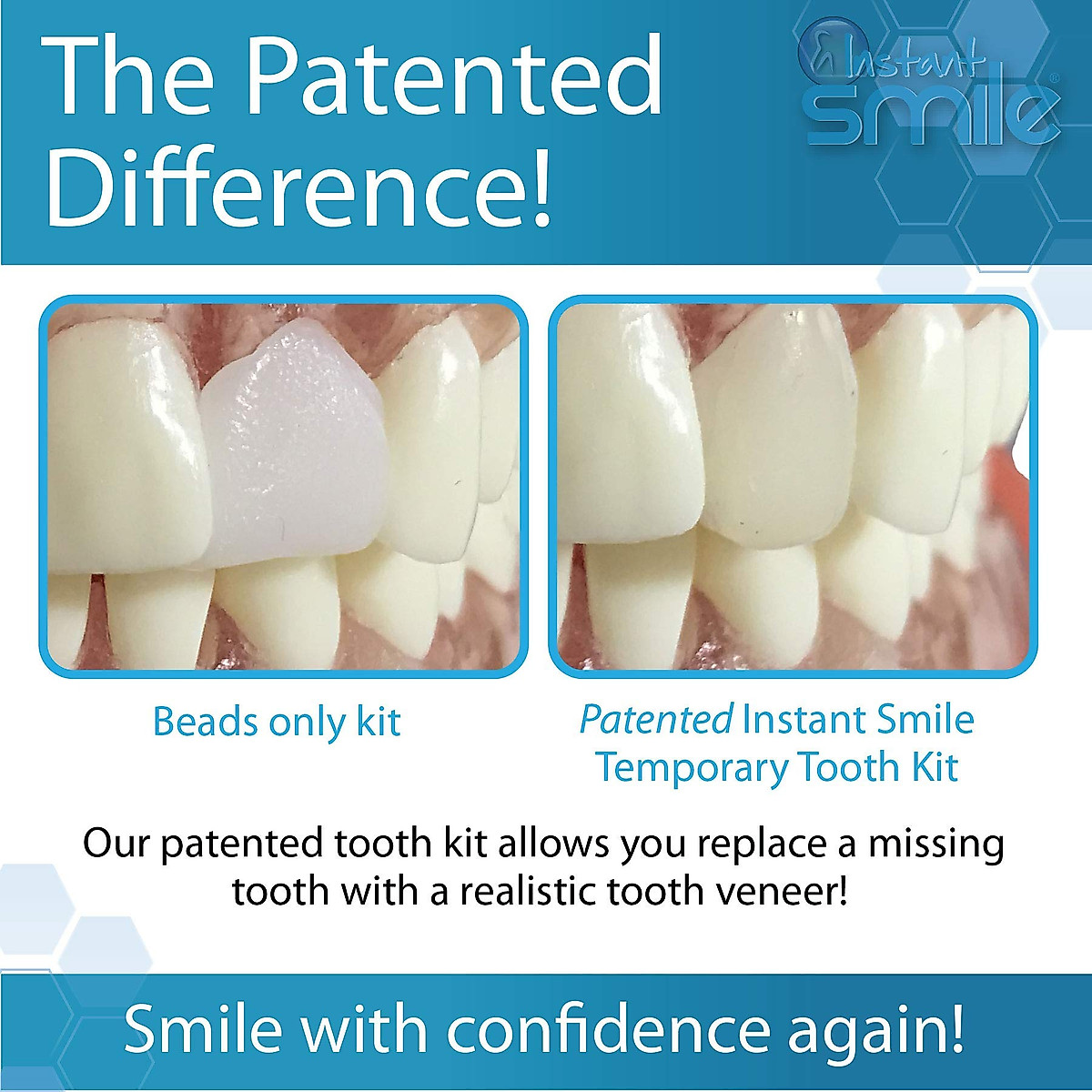 Instant Smile Complete Your Smile Tooth Replacement Kit with 3 Pack Fitting Beads