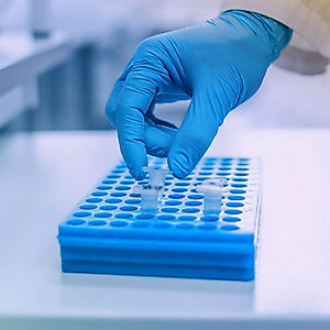 PATIKIL 2.0ML Plastic Centrifuge Tubes, 250 Pcs Microcentrifuge Tubes with Snap Cap and Graduated Marks for Sample Storage, Clear