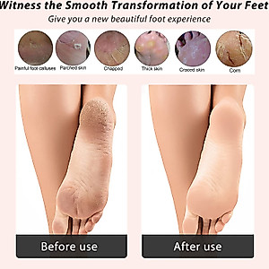 ICDI ICANdOIT Natural Bamboo Foot File Callus Remover-Multi Purpose 4 in 1 Feet Pedicure Kit with Foot Care Boar Bristle Brush,Pumice Stone,Foot Rasp,Sand Paper