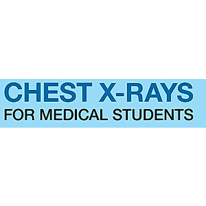 Chest X-Rays for Medical Students: CXRs Made Easy