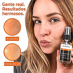 Vitamin C Serum for Face with Hyaluronic Acid, Anti Aging Serum, Vitamin C Serum for Face Dark Spots & Wrinkles, Face Serum for Women & Men, Vitamin C for Face, Vitamin C Face Serum by YEOUTH