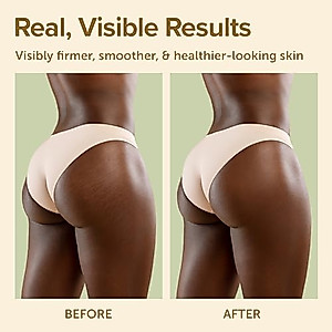 Bio Pure Skincare Oil - Moisturizer for Dry Skin - Pregnancy Stretch Mark Prevention - Oil for Scars - Stretch Mark Treatment with Sweet Almond for skin (4oz)