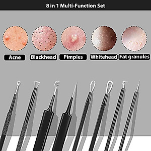 Glamne Blackhead Remover Pimple Popper Kit Acne Comedone Extractor Blemish Extraction Popping Tools (Black)