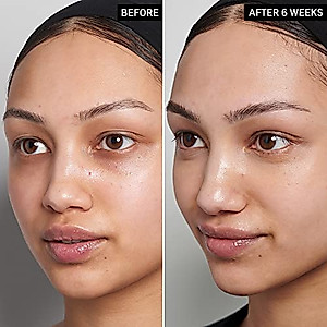 The INKEY List 15% Vitamin C + EGF Serum, Illuminate and Regenerate Dull Skin, Improve Skin Elasticity, 1.0 fl oz