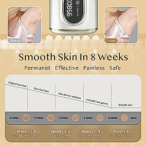 Tricklet T3 Home Use Hair Removal Device for Women And Men, Permanent IPL Hair Removal with Bluetooth Smart App Ice-Cooling Technology, 998,000 Flashes Hair Remover Device for Facial Arms Legs White